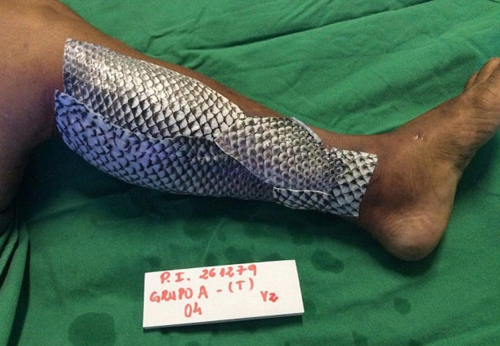 Fish Skin Bandages – Could fish scales hold the key to rapid wound ...