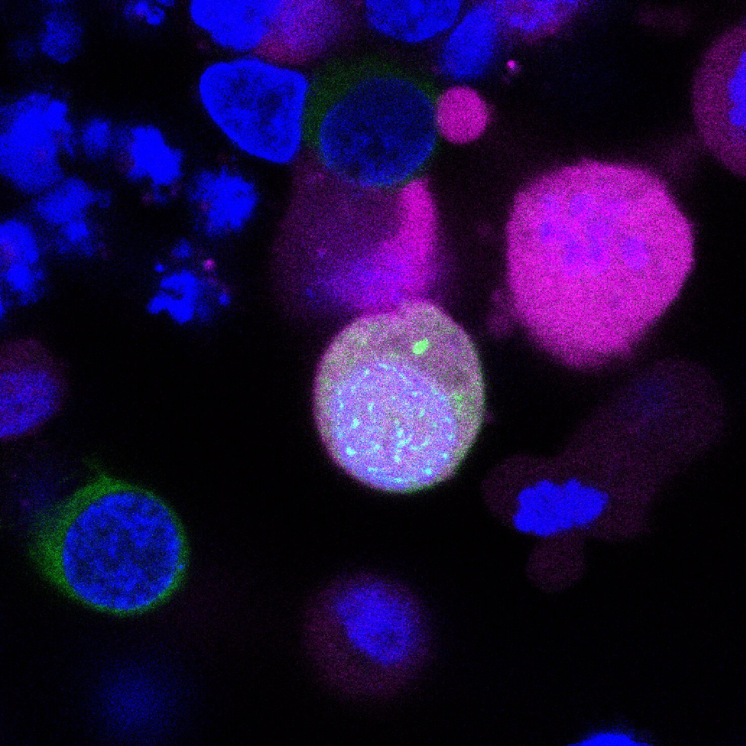 Lab-grown stem cells initiate key steps of human egg and sperm ...