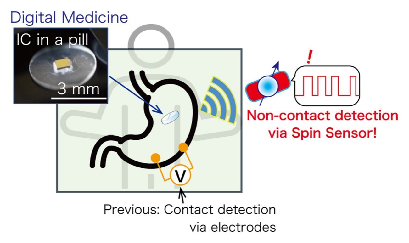 Non-invasive quantum spin sensor can detect digital pill signals ...